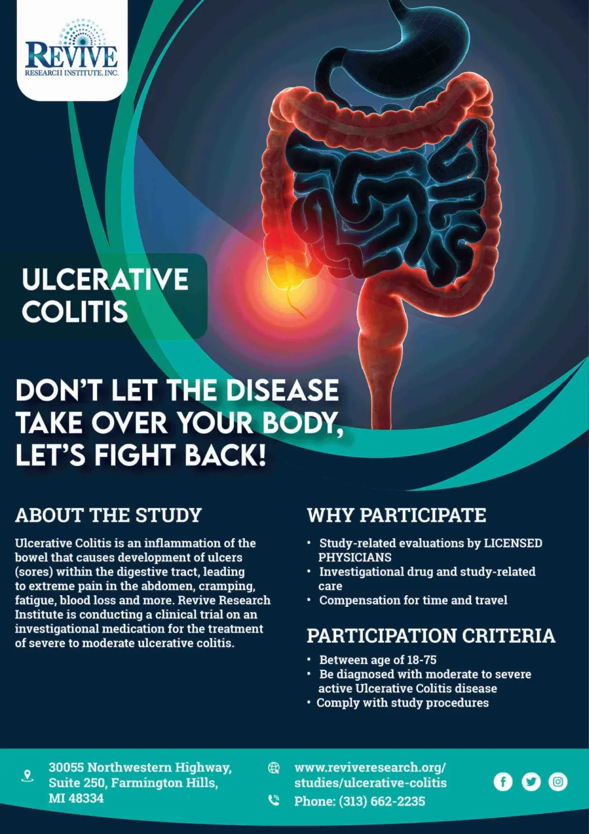 Ulcerative Colitis Ulcerative Colitis Treatment With SIMPONI®