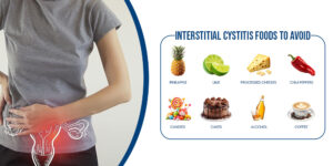 Interstitial Cystitis Foods to Avoid: Manage Bladder Pain Now