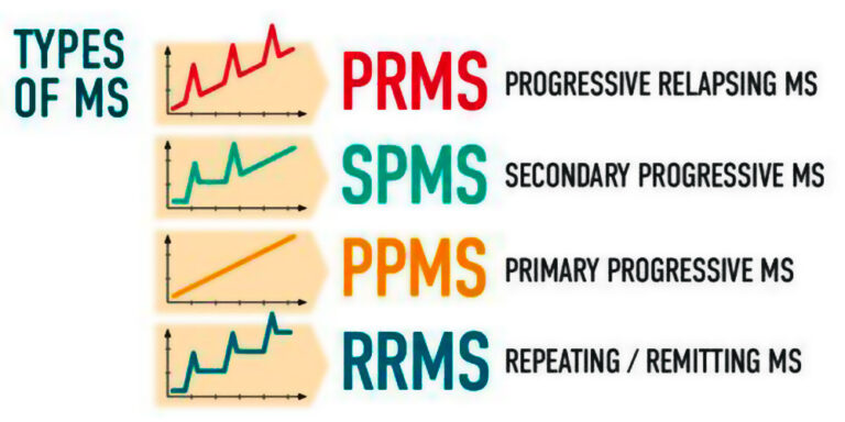 Living with MS? Take Our Multiple Sclerosis Quiz Today